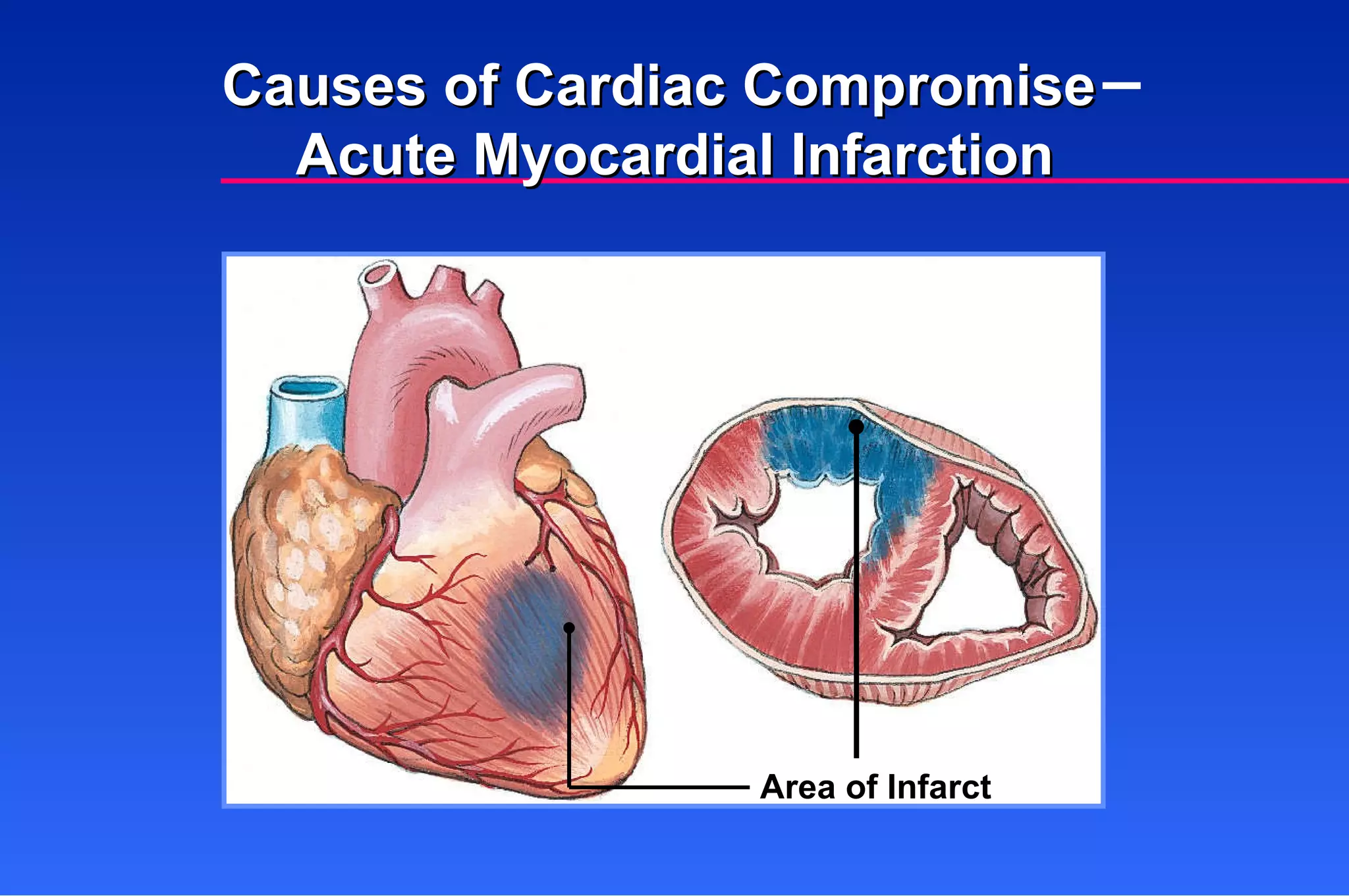 Cardiac Emergencies | PPT