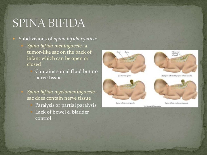 Physical Disabilties and TBI