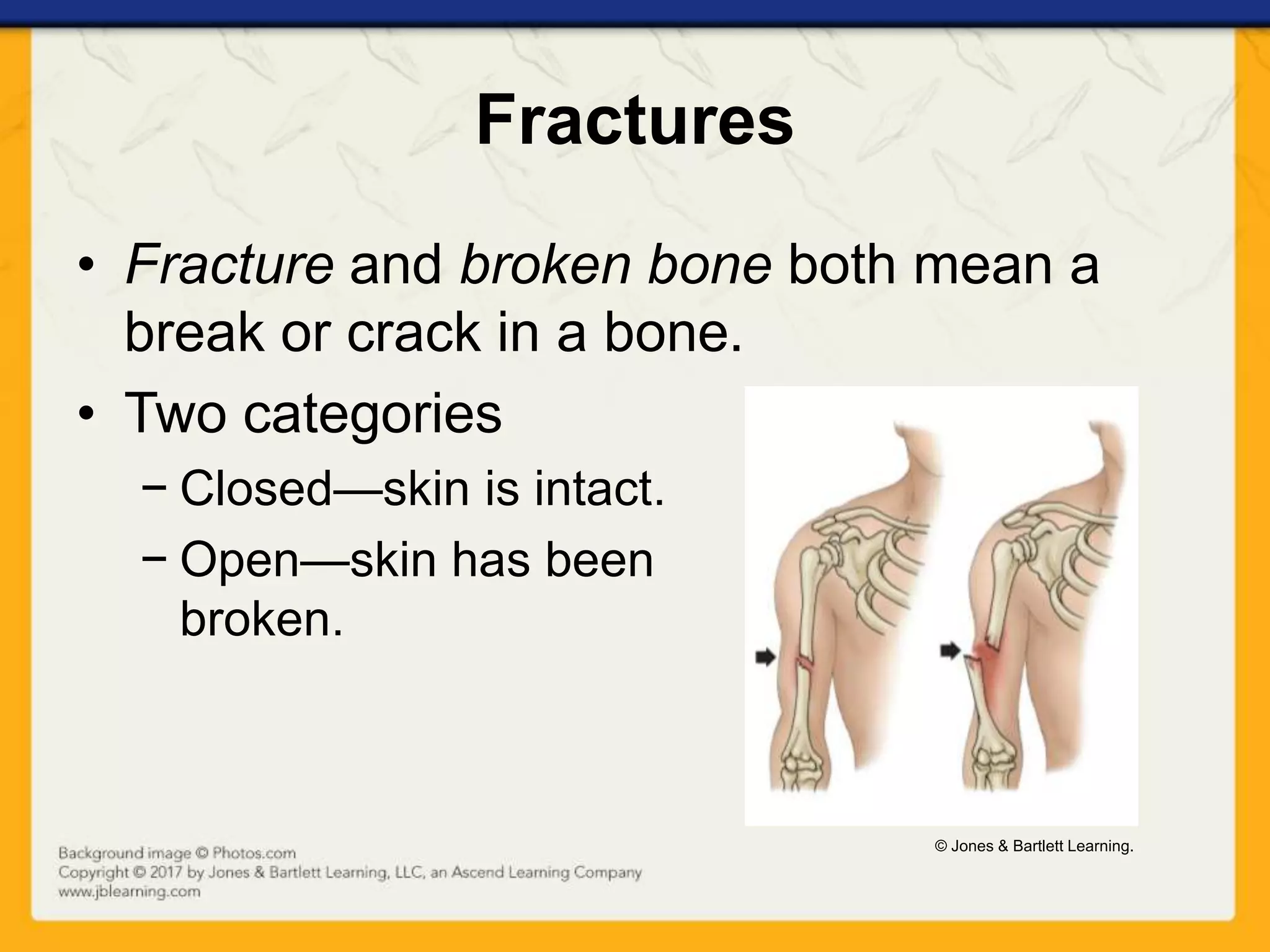 Ch14 presentation bone_joint_muscle_injuries | PPTX