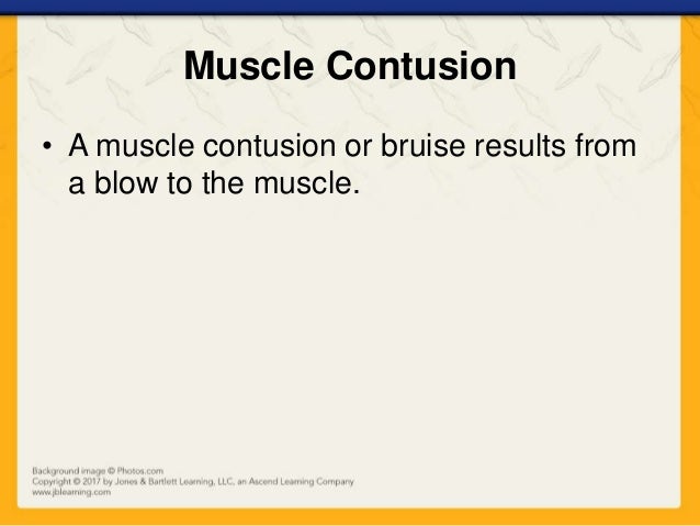 Ch14 presentation bone_joint_muscle_injuries