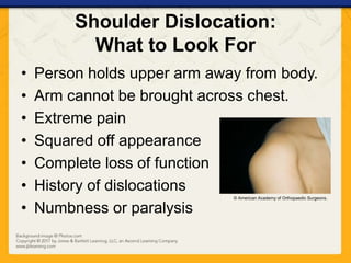 Ch15 presentation extremity_injuries | PPTX