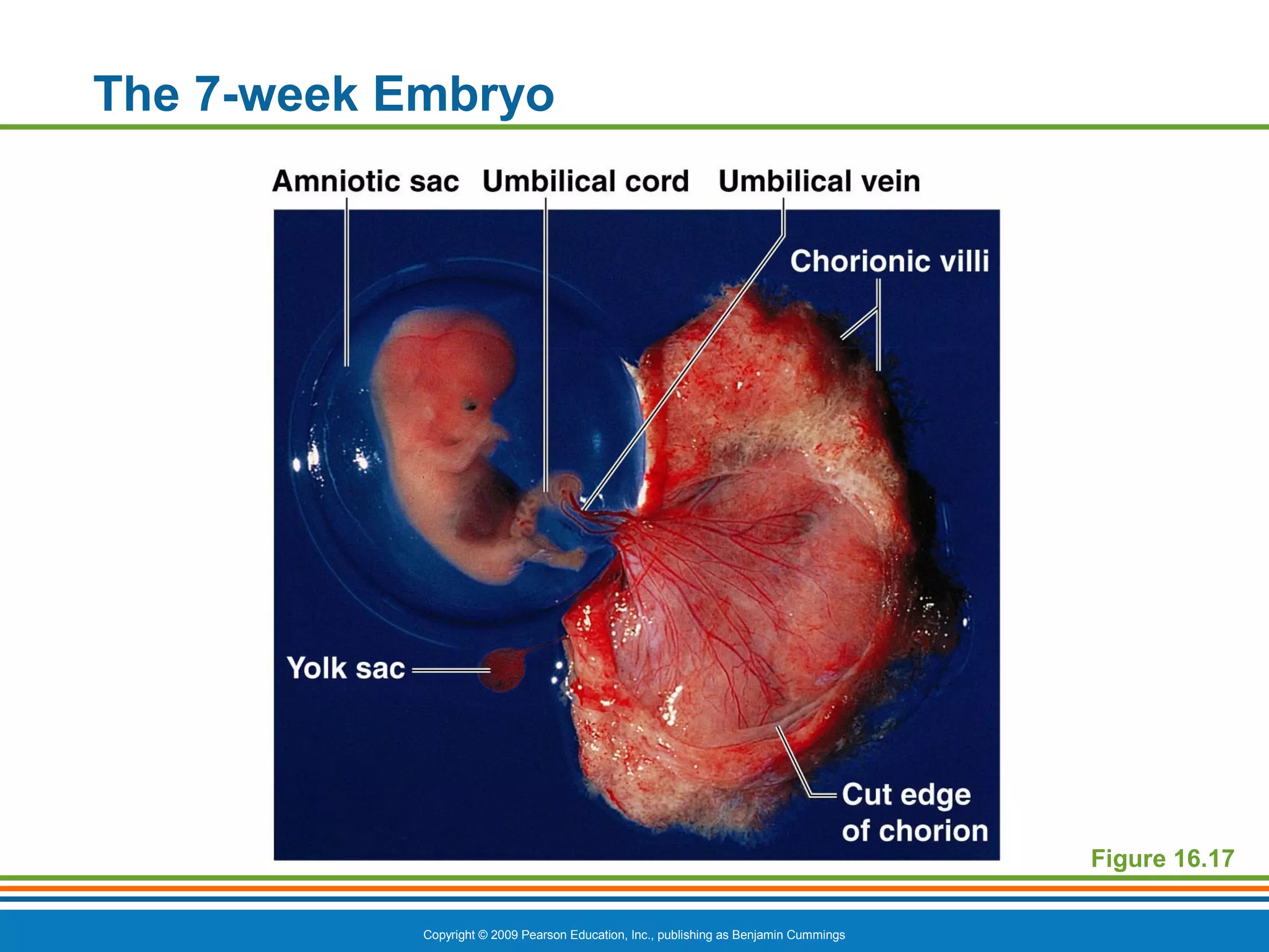 Ch16bppt fetal development honors | PPT