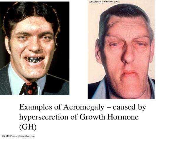 Ch 16_lecture pt a_sp2014