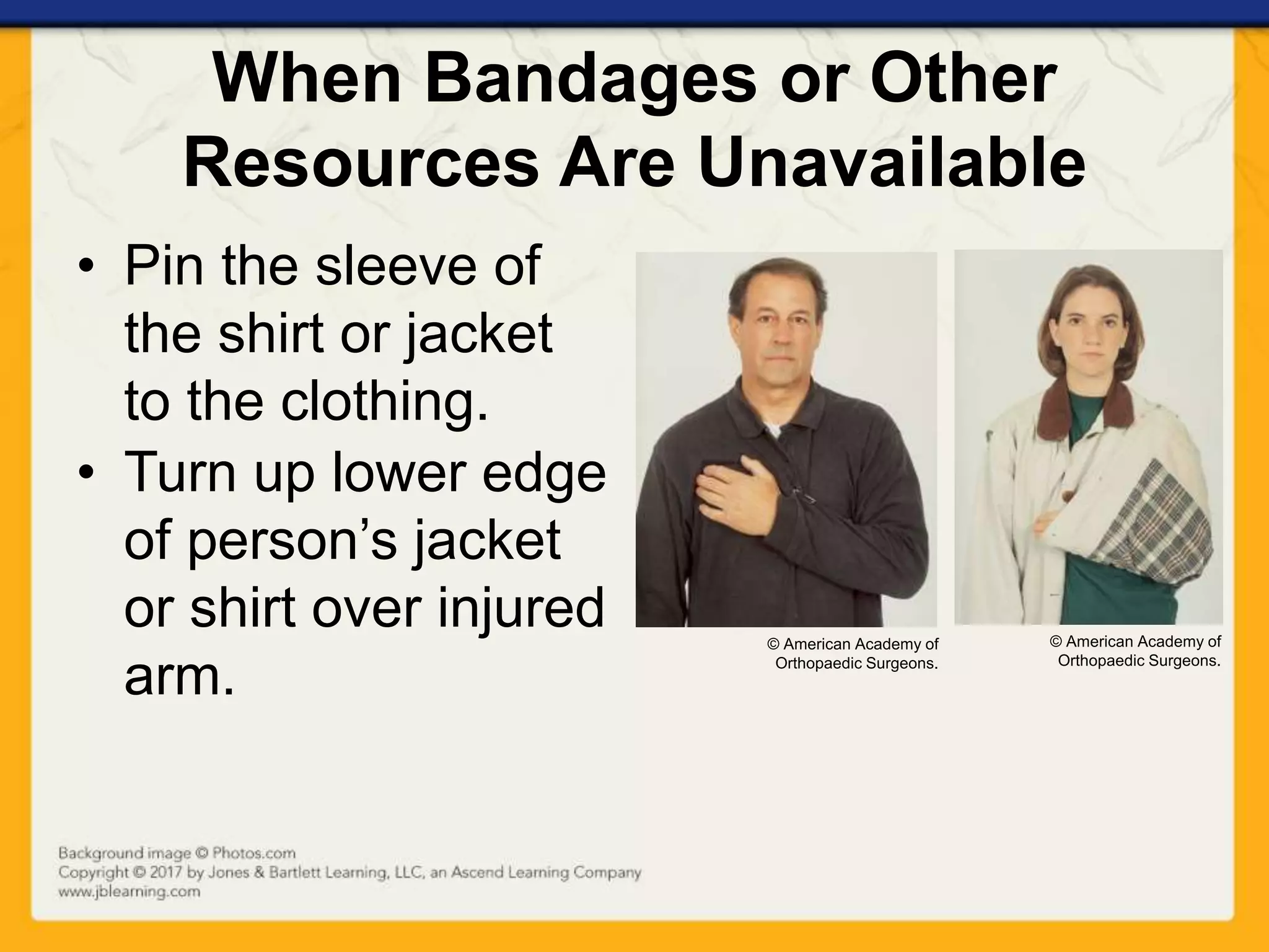 Ch16 presentation splinting_extremities | PPTX