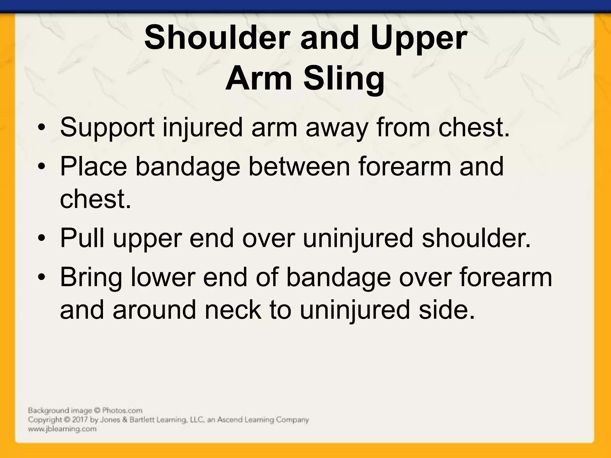 Ch16 presentation splinting_extremities | PPTX