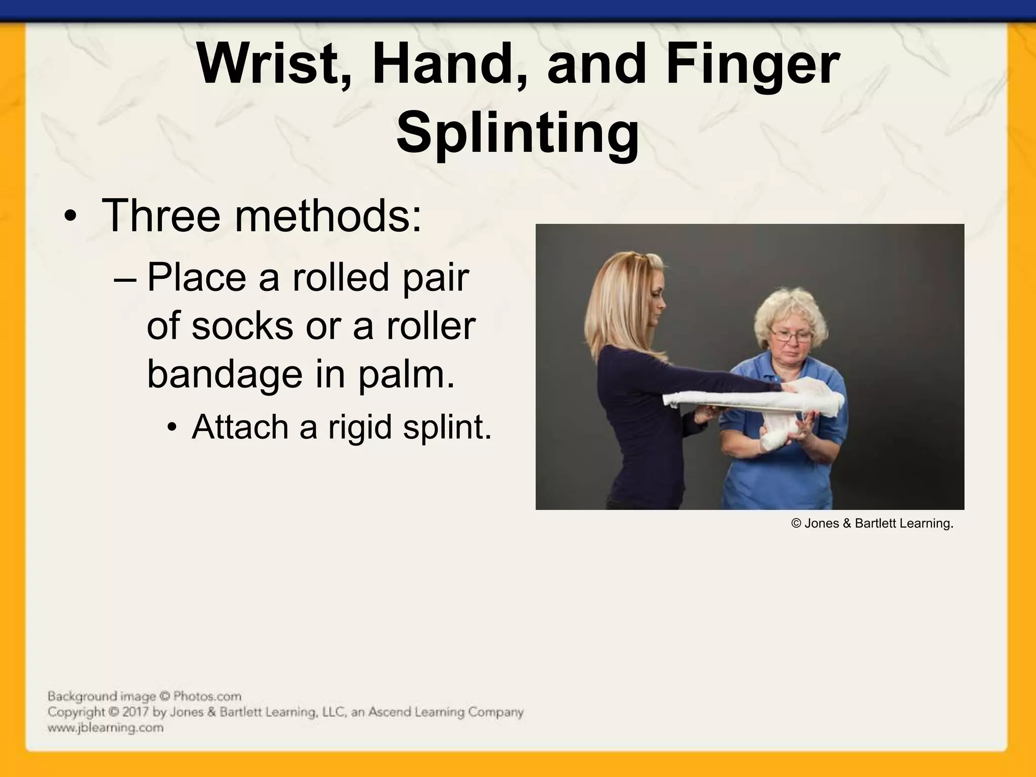 Ch16 presentation splinting_extremities | PPTX