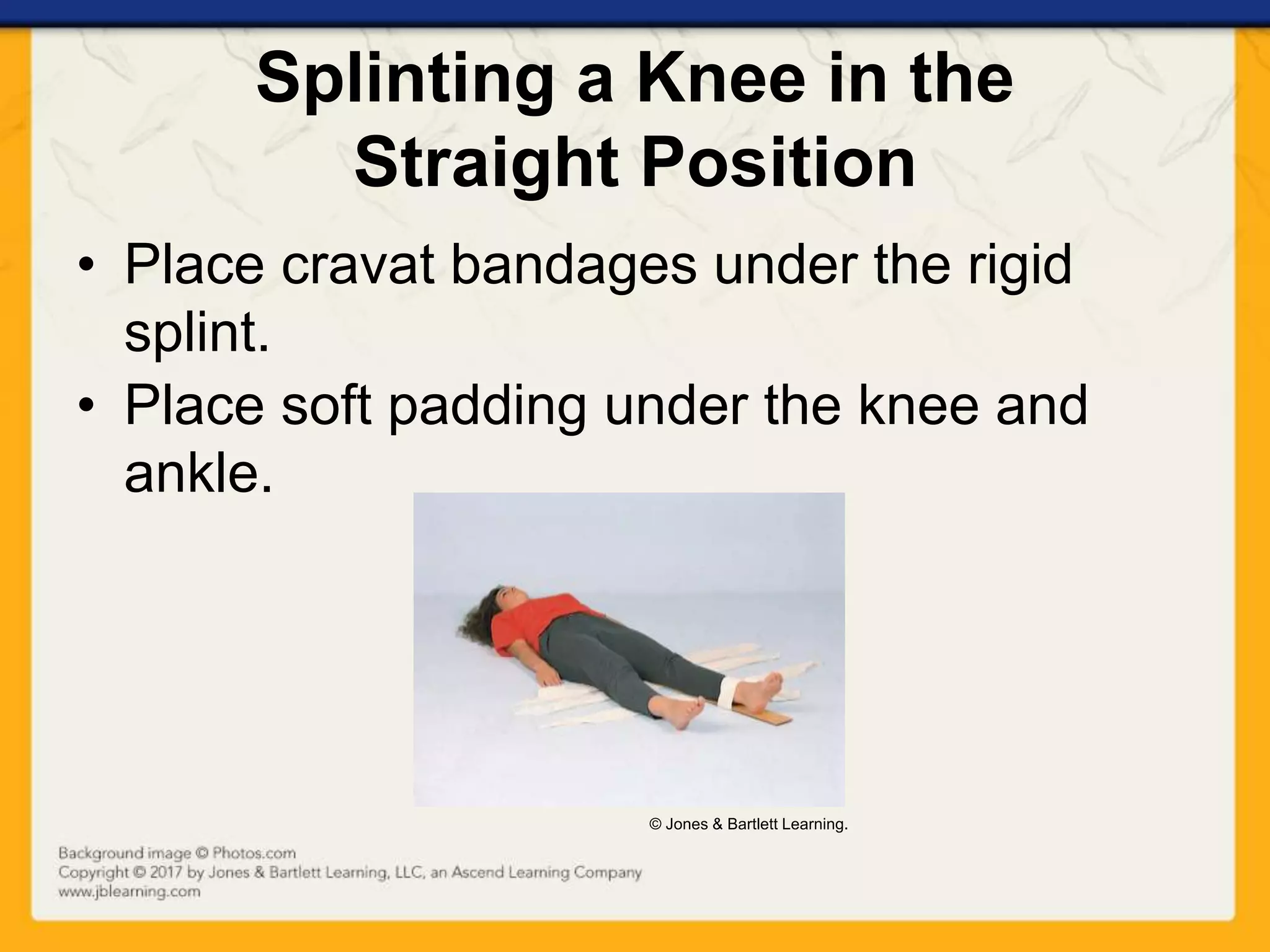Ch16 presentation splinting_extremities | PPTX