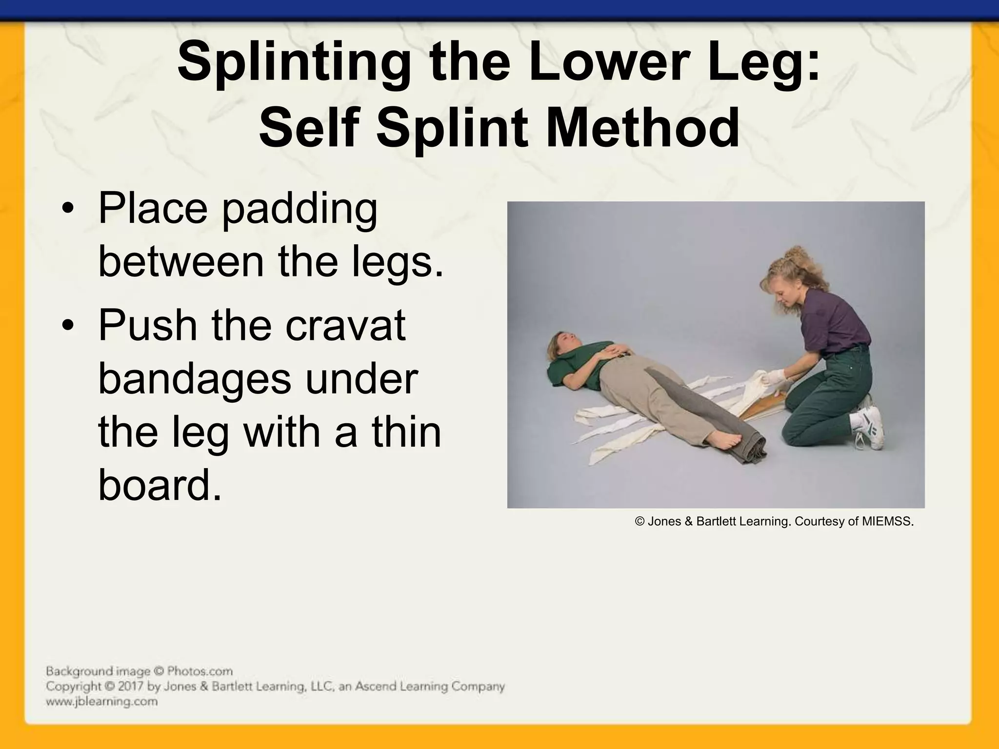 Ch16 presentation splinting_extremities | PPTX