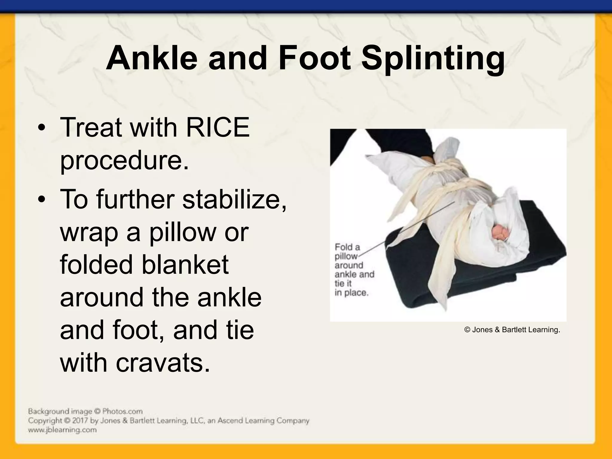 Ch16 presentation splinting_extremities | PPTX