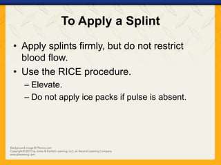 Ch16 presentation splinting_extremities | PPTX