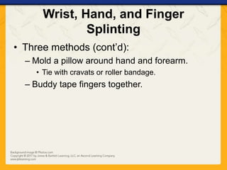 Ch16 presentation splinting_extremities | PPTX