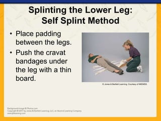 Ch16 presentation splinting_extremities | PPTX