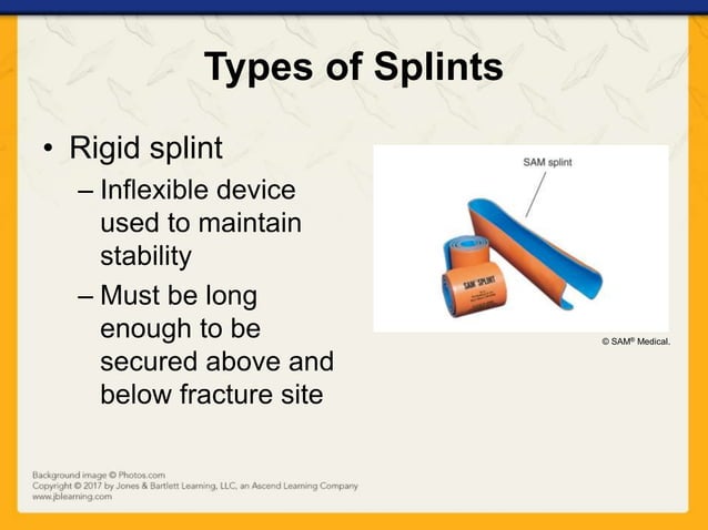 Ch16 presentation splinting_extremities | PPTX | First Aid | Injuries