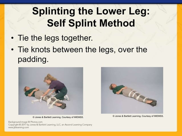 Ch16 presentation splinting_extremities | PPTX | First Aid | Injuries