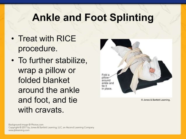 Ch16 presentation splinting_extremities | PPTX | First Aid | Injuries