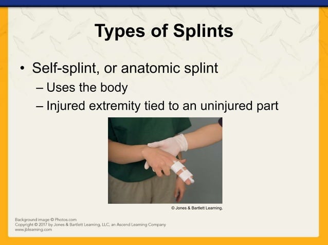 Ch16 presentation splinting_extremities | PPTX | First Aid | Injuries