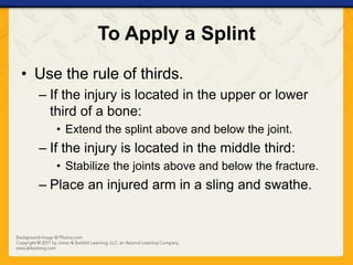 Ch16 presentation splinting_extremities | PPTX