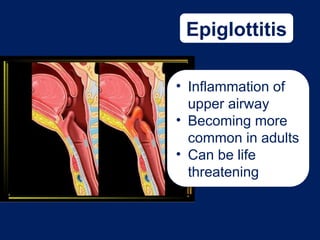 Chapter 16 Respiratory Emergencies for EMT | PPT