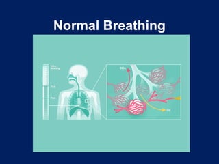 Chapter 16 Respiratory Emergencies for EMT | PPT