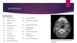 Complex Odontogenic Infections by Mari-Alina Timoshchuk.pptx