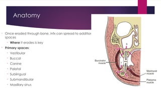 Complex Odontogenic Infections by Mari-Alina Timoshchuk.pptx