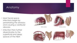 Complex Odontogenic Infections by Mari-Alina Timoshchuk.pptx