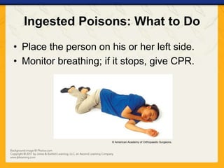 Ch18 presentation poisoning(1) | PPTX