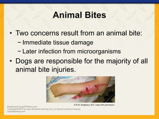 Octopus Beak Bite Wound