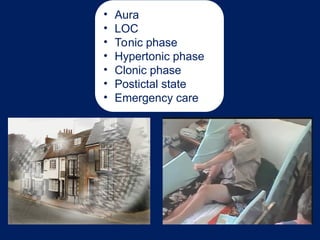 Chapter 19 Seizures & Syncope ppt for EMT | PPT