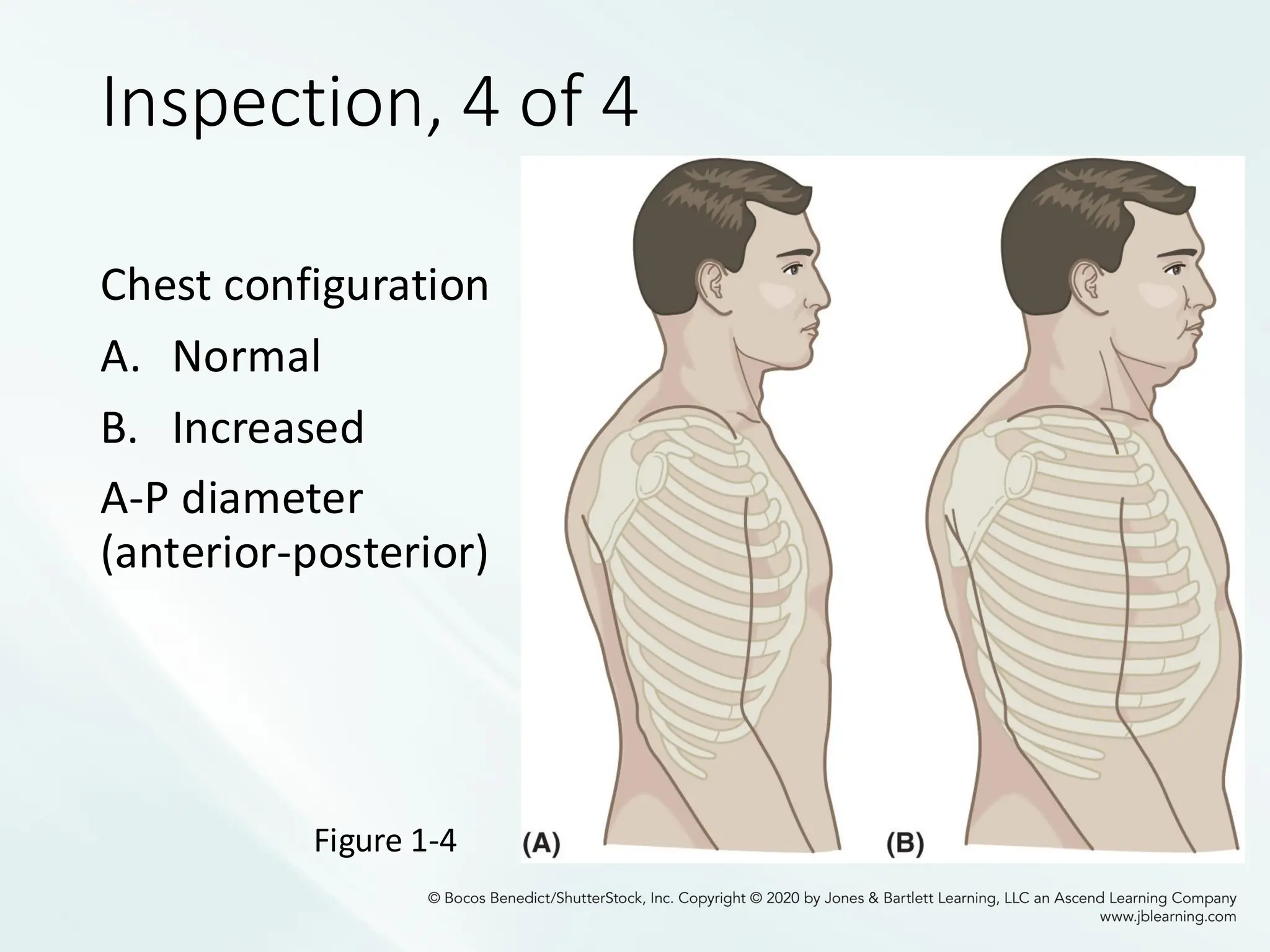 CH_1_Cardiopulm_assessment Medical Surg.pdf