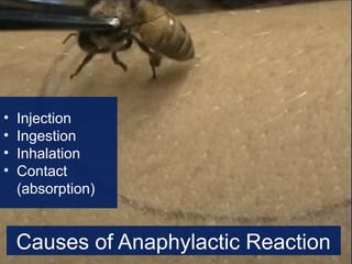 Chapter 21 Anaphylactic Reactions for EMT | PPTX