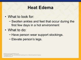 Ch21 presentation heat_emergencies | PPTX | First Aid | Injuries