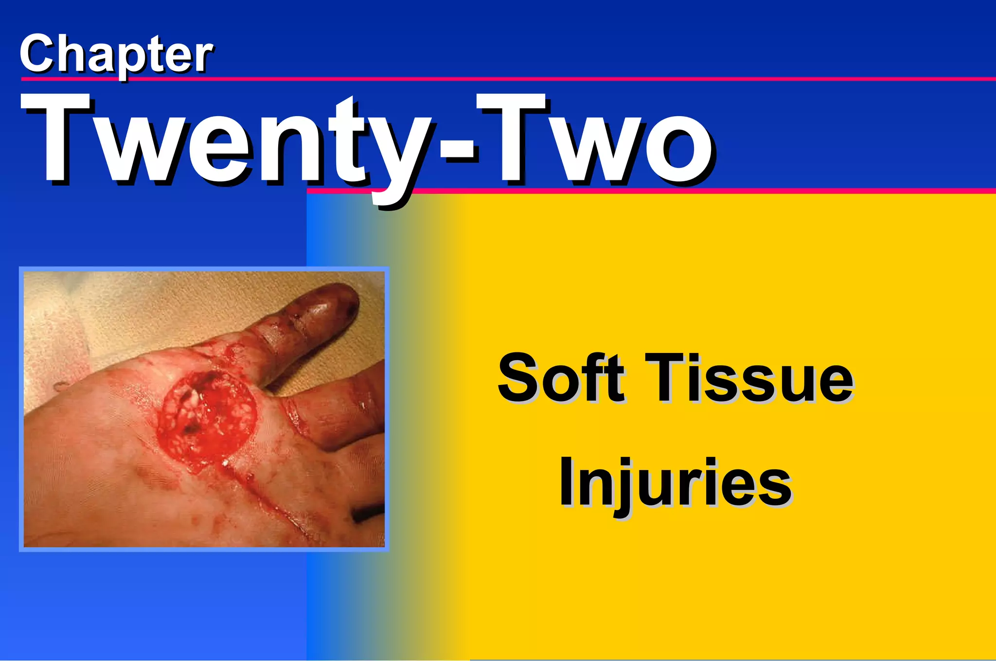 Soft Tissue Injuries | PPT