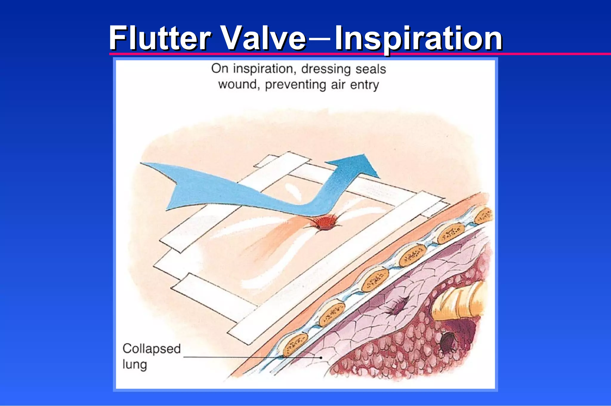 Soft Tissue Injuries | PPT