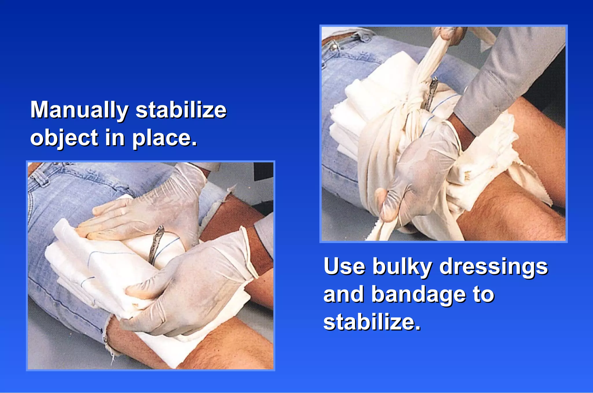 Soft Tissue Injuries | PPT