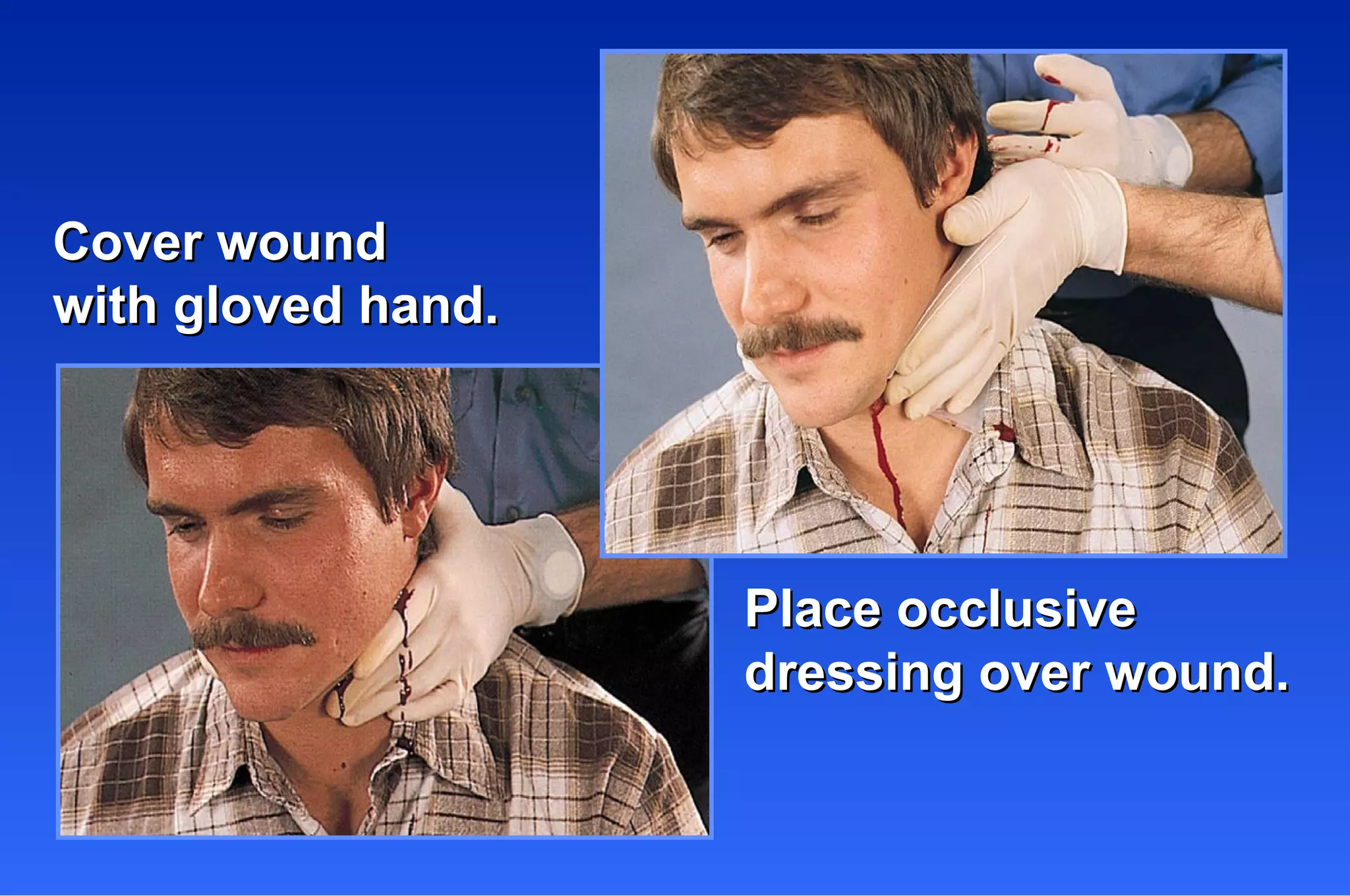 Soft Tissue Injuries | PPT