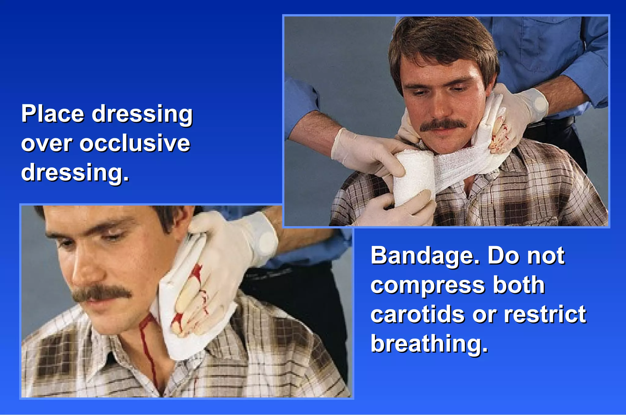 Soft Tissue Injuries | PPT