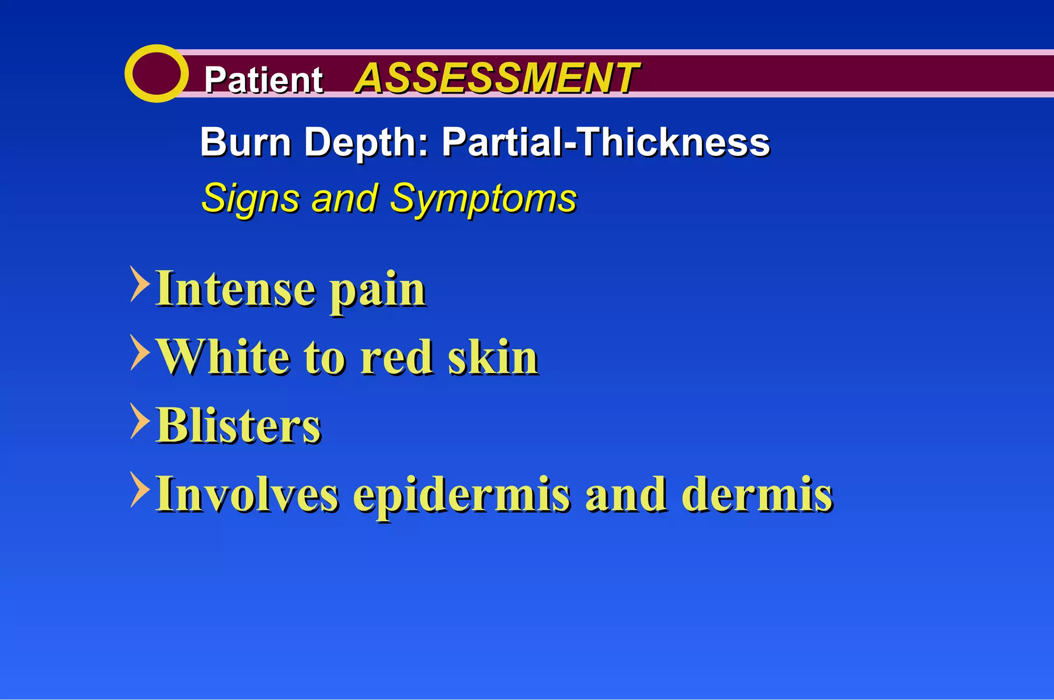 Soft Tissue Injuries | PPT