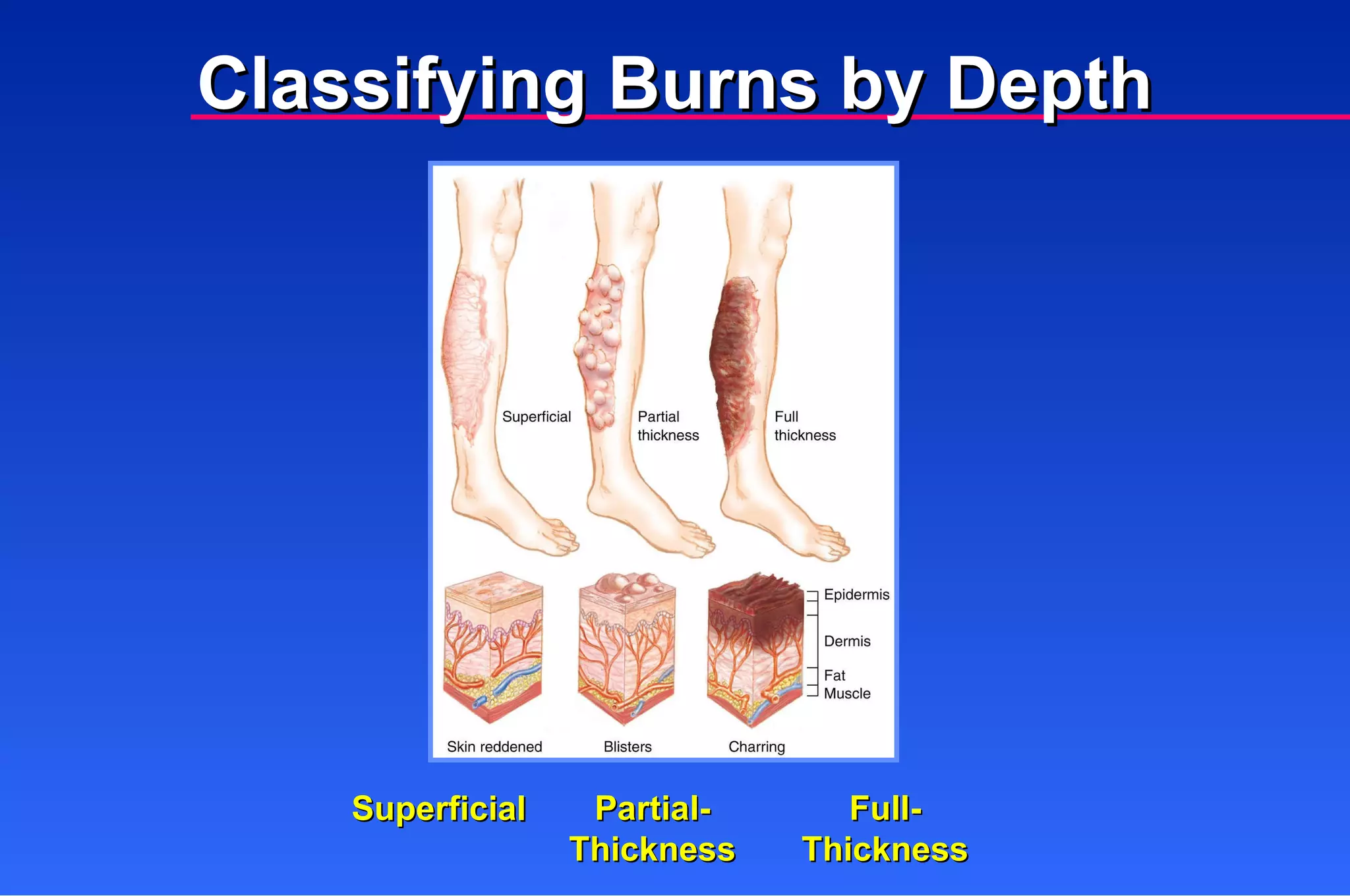 Soft Tissue Injuries | PPT