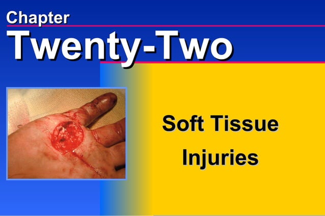 Soft Tissue Injuries | PPT