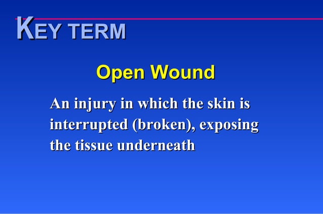 Soft Tissue Injuries | PPT