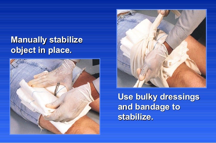 Soft Tissue Injuries