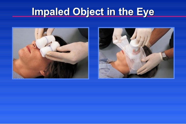 Soft Tissue Injuries