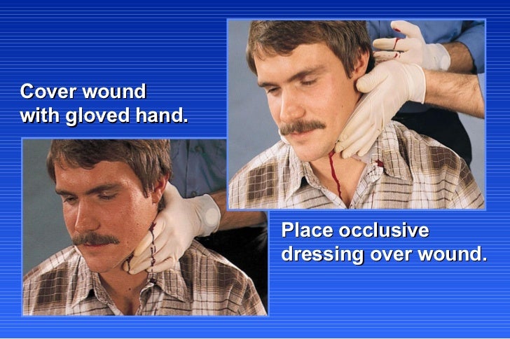 Occlusive Dressing Plastic