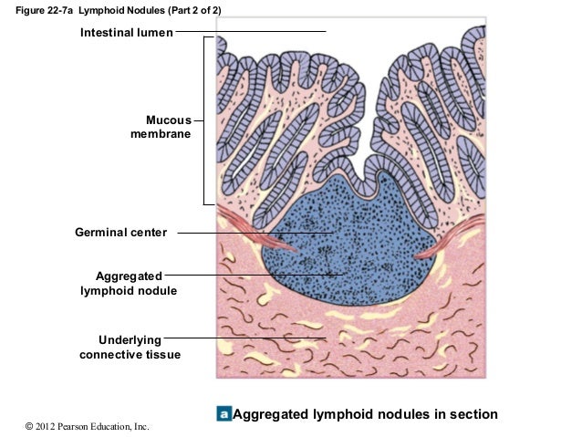 169 Ch 22_lecture_presentation