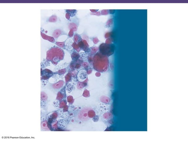 Ch 22_lecture_presentation | PPTX