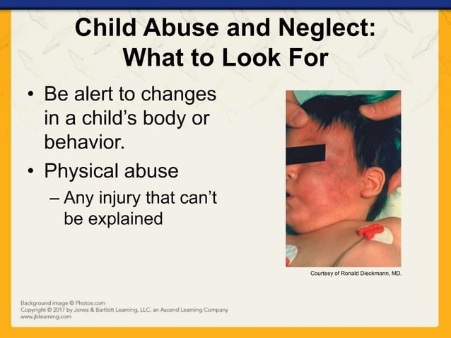 Ch23 presentation behavioral_emergencies | PPT