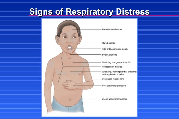Respiratory Distress In The Pediatric Patient Assessment