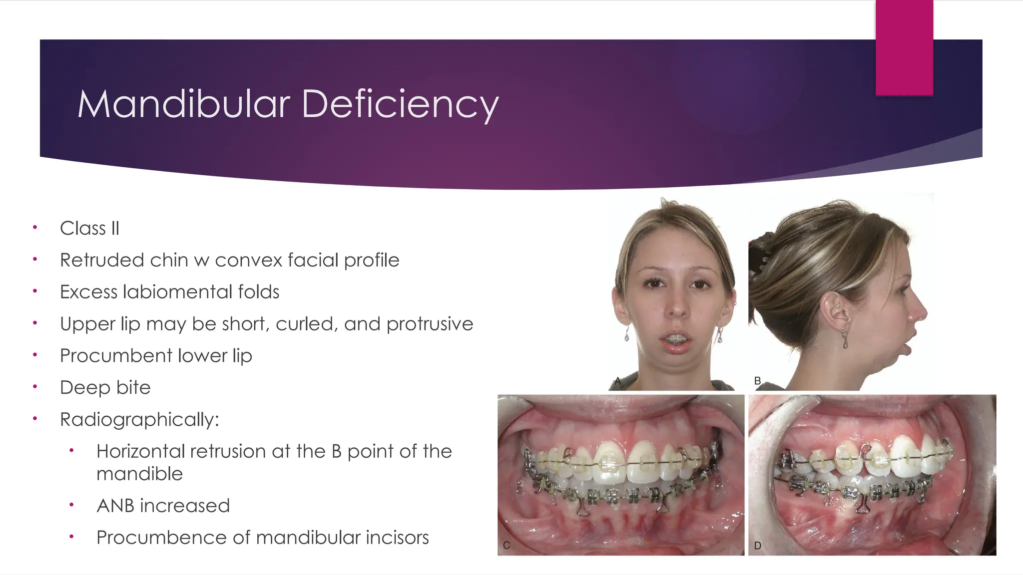 Correction of Dentofacial Deformities by Mari-Alina Timoshchuk.pptx