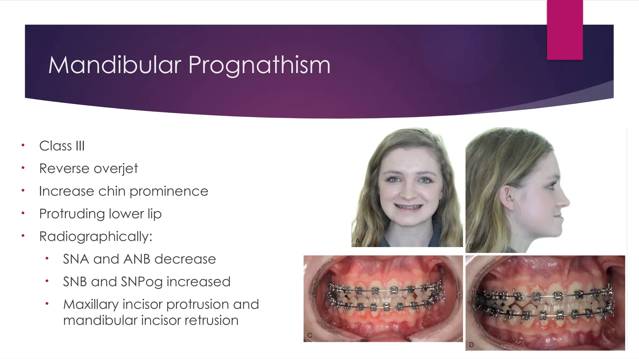 Correction of Dentofacial Deformities by Mari-Alina Timoshchuk.pptx